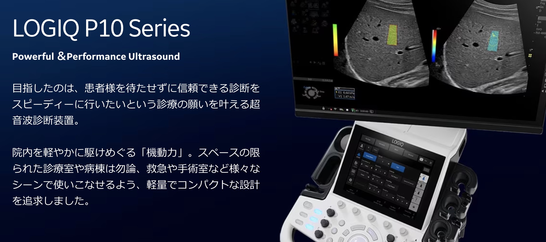 汎用超音波画像診断装置 LOGIQ P10シリーズ | 株式会社EMILUCK